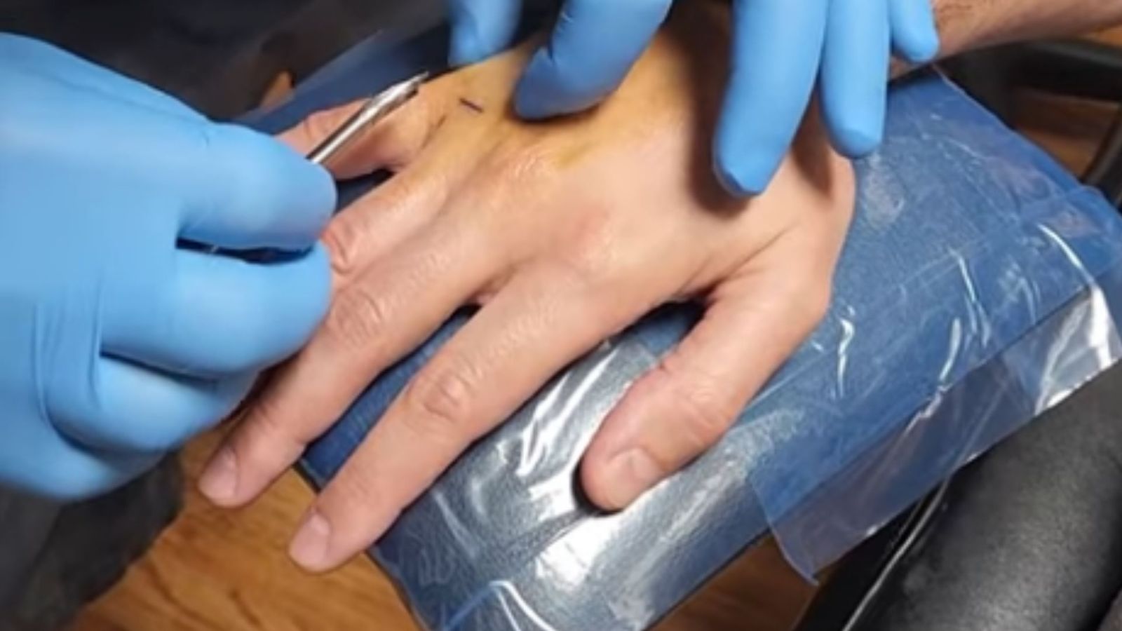 Inserting A Tesla Key Into Your Body Is Apparently A Thing